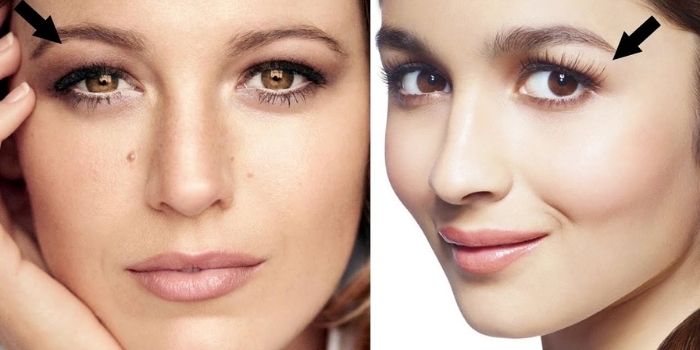 How To Fix Hooded Eyes Without Surgery? - Yastrid Medical Aesthetic ...