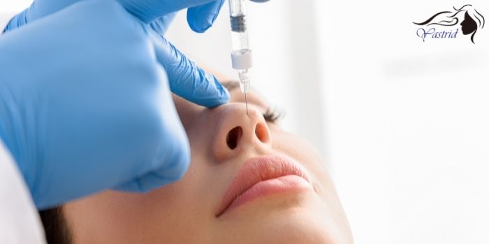 Advantages of Nose Thread Lift - Yastrid Medical Aesthetic Supplier