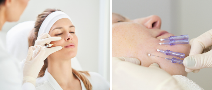 Botox for Sagging Cheeks | How It works | Risks and Benefits - Yastrid ...