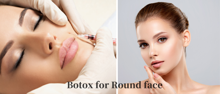 Is Masseter Botox Good for Round Faces? - Yastrid Medical Aesthetic ...