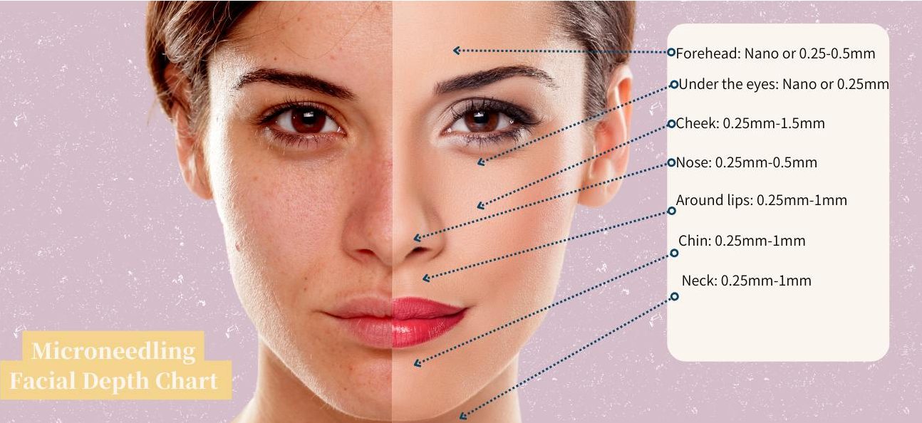Derma Pen for Face