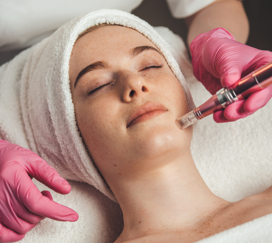 Derma Roller vs Derma Pen: Which is Best Microneedling? - Yastrid ...