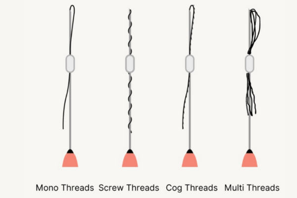 How Much Does a Meso Thread Face Lift Cost?