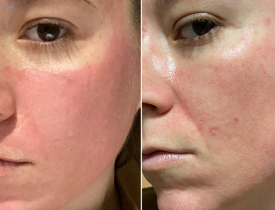Yastrid Repair Face Mask