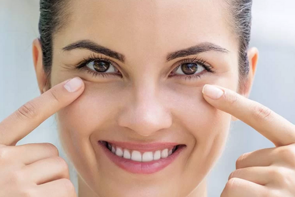 How to Fix PDO Threads Under Eyes Bruising - Yastrid Medical Aesthetic ...